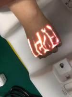 China Vein finder machine for sale