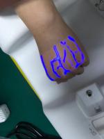 China Vein finder machine for sale