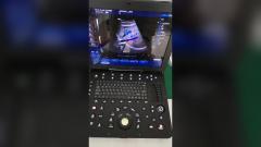 4D Portable color doppler machine BR-US15(V3.0)