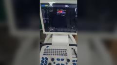 Trolley color doppler Ultrasound Diagnostic System