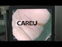Equipamento Médico Olympus Reparado A Solução Última para Serviços Médicos