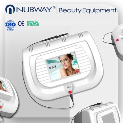 China 30mhz super power and great effect spider vein removal machine reduce red blood vessel for sale