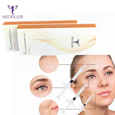 China Cross Linking Hyaluronic Acid Dermal Filler Wrinkle Reducer Injections for sale