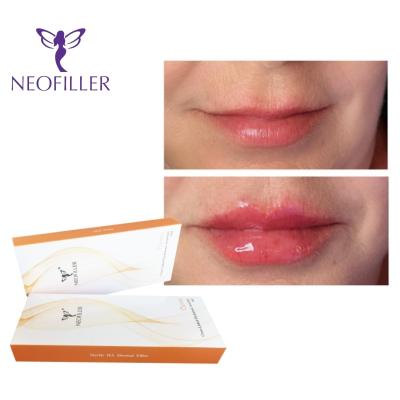 China 24mg-ml 1ml 2ml Syringe Derm Hyaluronic Acid Dermal Filler Injectable Gel Facial Rejuvenation Enhancement for sale