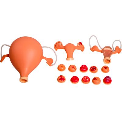 China Simulador ginecológico Vaginal Pelvic Exam Simulator del útero del reemplazo en venta