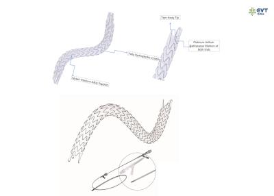 China Large Lumen Urethral Stent Hydrophobic Nitinol Design For Precision Placement for sale