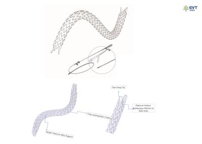 China Maximized Lumen URS Stent With Hydrophobic Nitinol Technology Anti Embedding Coating for sale