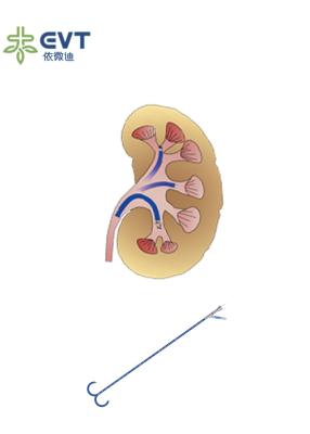 China High Value Ureteral Access Sheath Endourology Practices Access Sheath Urology for sale