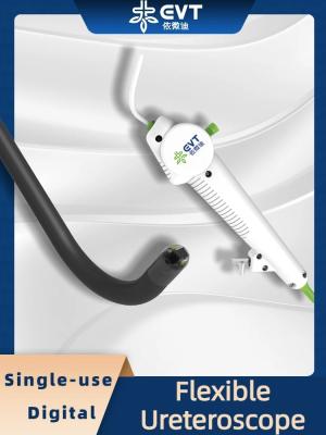 중국 소아 결석 관리 – 초슬림 일회용 연성 요관경 판매용