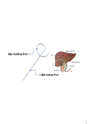 China Long Pigtail Loop Biliary Drainage Tube for Internal‑External Bile Drainage Medical Grade PU High Flow Design for sale