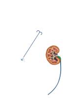 Quality Dual Lumen Ureteral Access Sheath Endoscopic Procedures Access Sheath Urology for sale