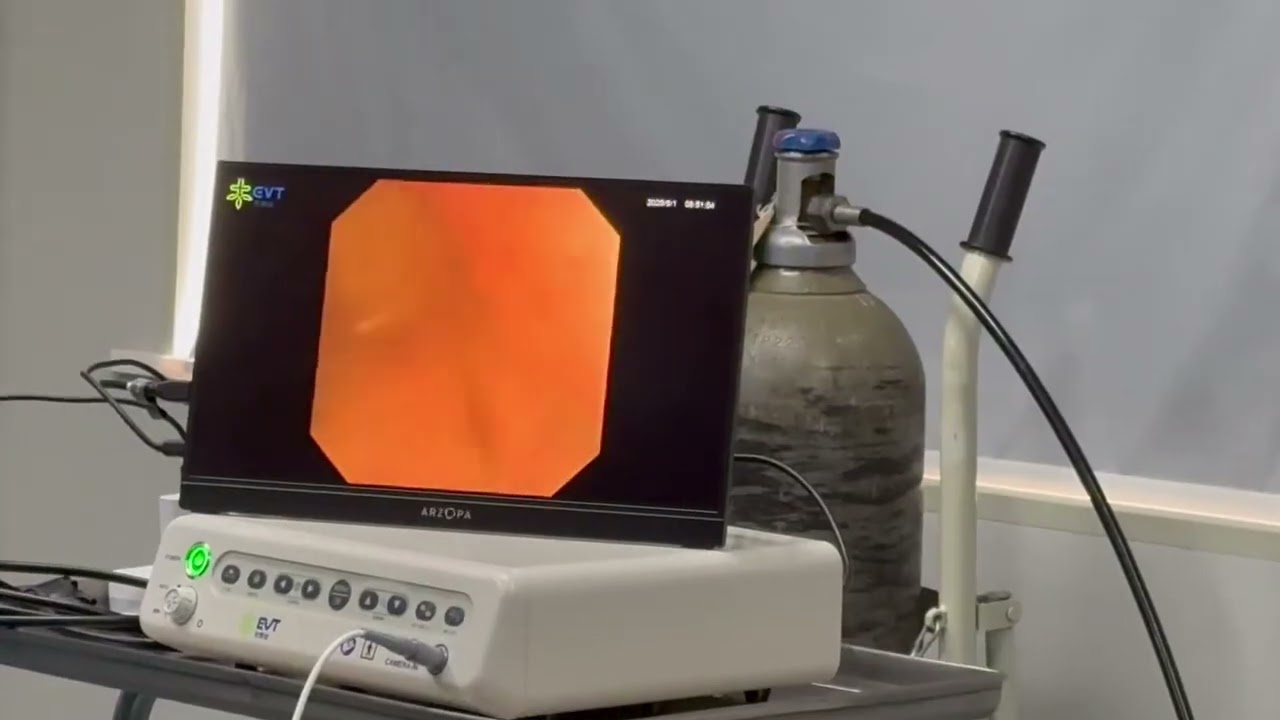 Cholangioscope numérique flexible à usage unique DU503810R