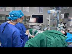 Pressione negativa Accesso ureterale Guarnizione Clearance di pietre idrofili Accesso Guarnizione Urologia