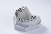 Quality Multiple Missing Teeth Implant Hybrid Prosthesis For Chewing And Speaking for sale