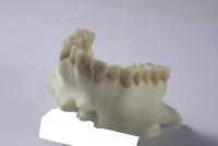 Quality Presicion Fit Implant Supported Dentures Implant Bar With Locator Attachments for sale