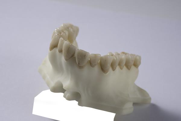 Quality Presicion Fit Implant Supported Dentures Implant Bar With Locator Attachments for sale