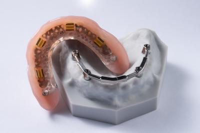 China Perfect Fit Hybrid Combination Dentures Wear Resistance Precision Attachment Denture for sale