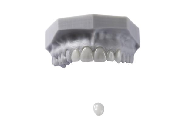 Quality Impact Resistant Dental Laminates And Veneers CAD CAM Veneers High Esthetic for sale