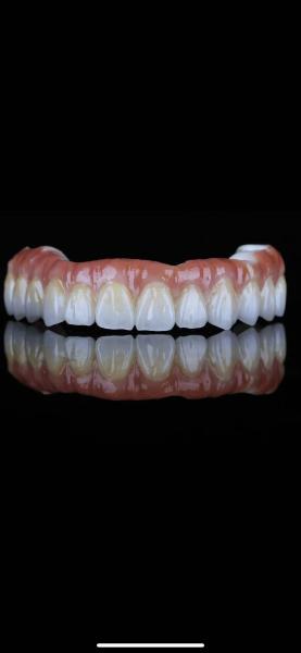 Quality Dental Implant Crown And Bridge High Esthetics Porcelain Crown Natural Looking for sale