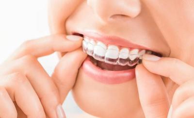 China Medical Grade Thermoplastic Clear Aligner Orthodontic Invisible Braces For Dental Clinics for sale
