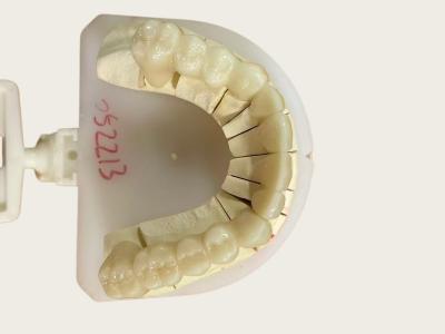 China Precise Dental Lab Crowns High Esthetic Porcelain Zirconia Tooth Crowns Natural Looking for sale