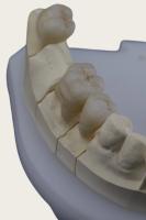 Quality Dental Lab Full Contour Zirconia Crowns High Translucency Solid Zirconia Crowns for sale