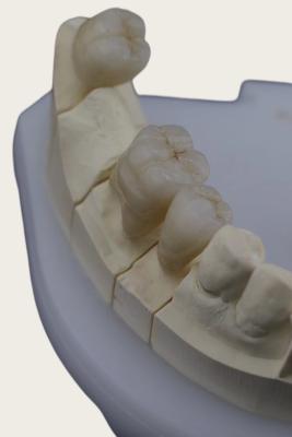China Dental Lab Full Contour Zirconia Crowns High Translucency Solid Zirconia Crowns for sale