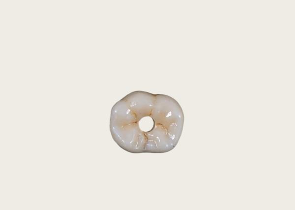 Quality Natural Looking Biocompatible Dental Implant Crown Bridge For Dental Restoration for sale
