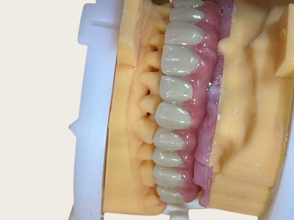 Quality Customized Dental Implant Crown Bridge Tibase Zirconia Abutments Accurate Fit for sale