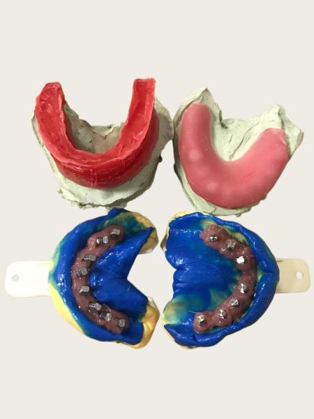 Quality Zirconia Dental Implant Crowns Titanium CAD CAM Abutments For Tooth Restoration for sale