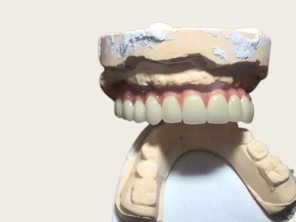Quality High Accuracy Esthetic Full Zirconia Bridge With Titanium Bar Screwed Retained for sale