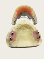 China Accurate Combination Dentures Removable Partial Denture Natural Appearance for sale