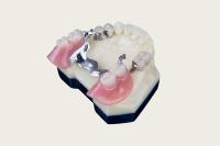 China Dental Removable Precision Attachment Partial Denture High Strength Customizable for sale