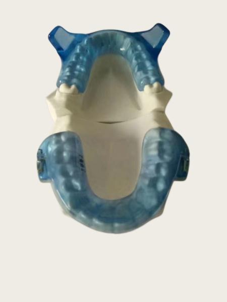 Quality Full Anatomy Screw Retained Implant Bridge Full Arch Dental Implant Bridge for sale