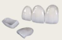 Quality Ivoclar Emax Laminate Veneers Translucent Esthetic Restorations Dental Clinic for sale