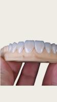 Quality Dedicated Dental Laboratory Laminates And Veneers Customized Esthetic Restoratio for sale