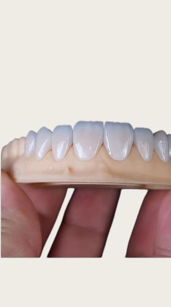 Quality Dedicated Dental Laboratory Laminates And Veneers Customized Esthetic Restorations for sale