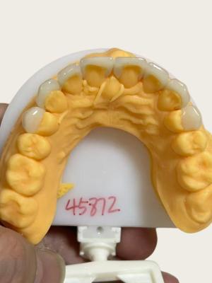 China Customized Dental Laminates And Veneers Long Lasting Dental Teeth Veneers for sale