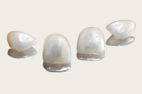 Quality High Esthetic Translucent Emax Dental Veneers Porcelain Laminate Veneers for sale