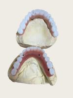Quality Snap In Implant Supported Dentures Natural Looking Full Arch Implant Solutions for sale