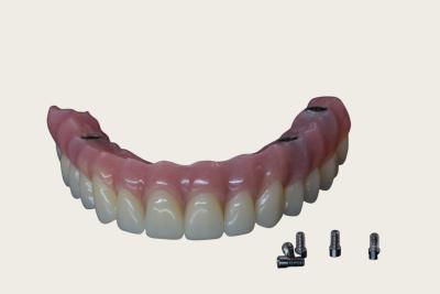 China Perfect Fit Implant Retained Dentures Dental Solution For Missing Teeth for sale