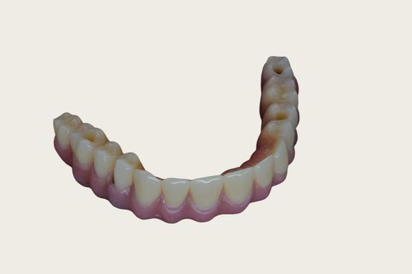 Quality Precise Dental Implant Supported Dentures Implant Locator Attachment Natural Looking for sale