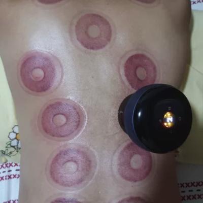 Cina Fisioterapia a infrarossi Dispositivo intelligente per la cupping e lo scrapping per il dimagrimento anti cellulite in vendita