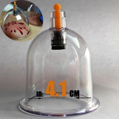 Cina Coppe Hijama monouso sterili Y3 da 4 cm per drenaggio linfatico in vendita