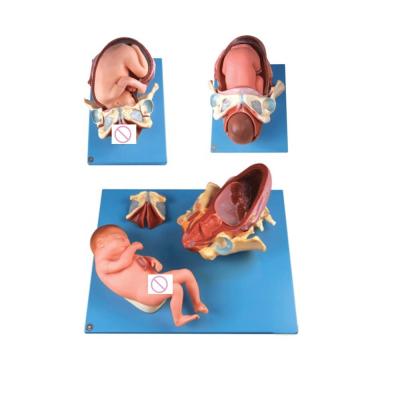 China Advanced PVC Childbirth Process Demonstration Model Full Term Fetal Birthing Training for sale