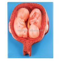 China Human Life Size Embryo Development Models with Highly Detailed Anatomical Structures for sale