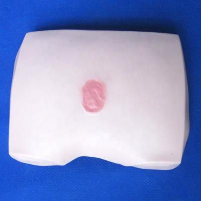 China Decubitus Illness Evolution Models for Hospitals Streamlining Pressure Ulcers Nursing for sale