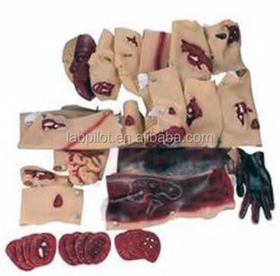 China Model voor noodopleiding Advanced PVC Facial Burn Trauma Evaluation Model Te koop
