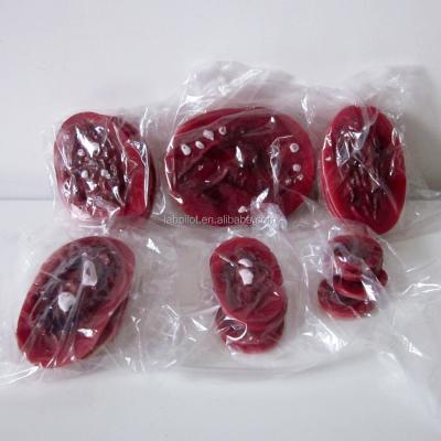 China Model voor noodopleiding Advanced PVC Facial Burn Trauma Evaluation Model Te koop