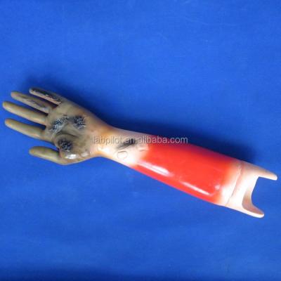 China Geavanceerde PVC-trauma-modellen voor training in wondverpleegkunde en demonstratie van patiëntenzorg Te koop
